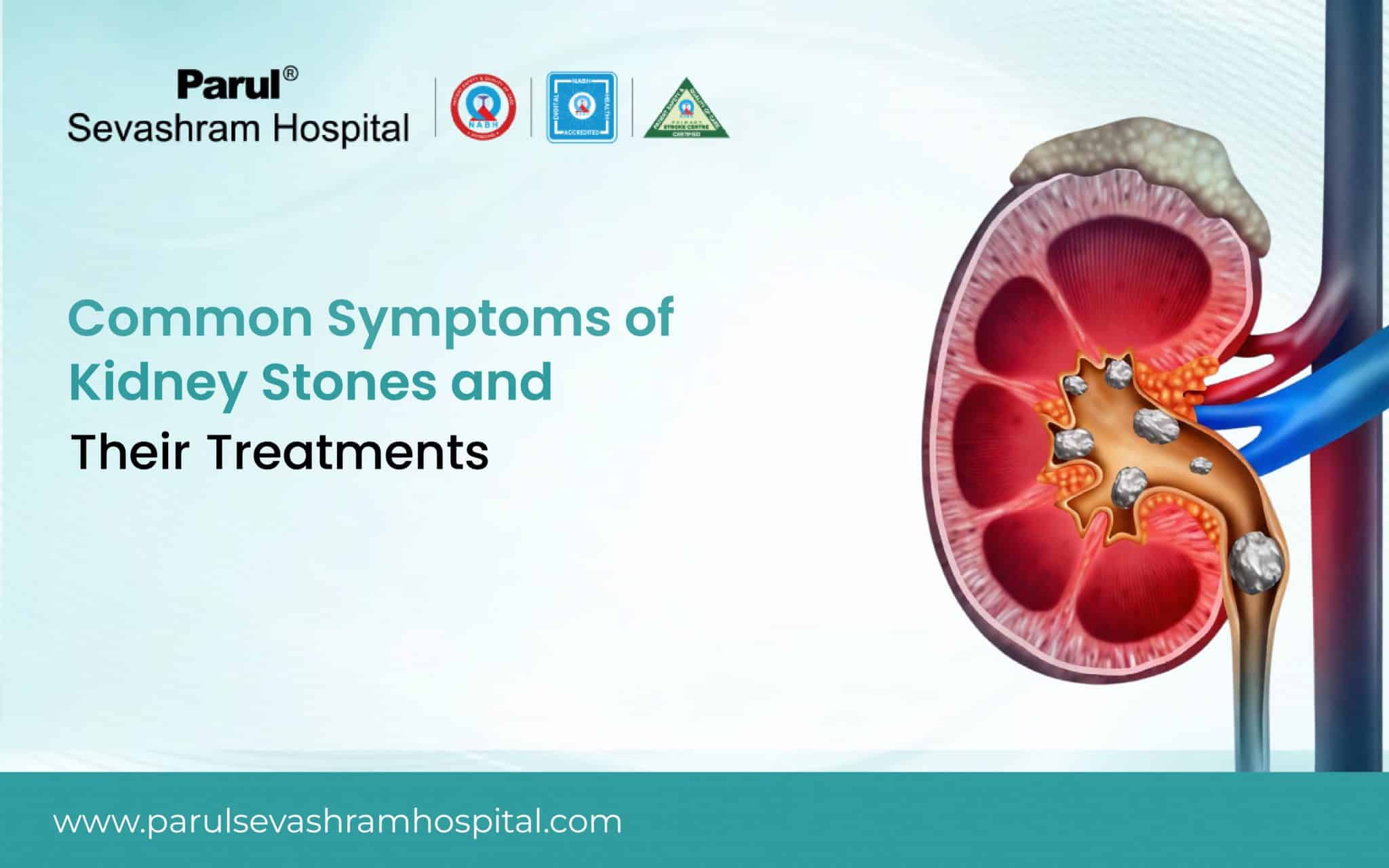 Understanding Kidney Stones: Symptoms and Treatment Options