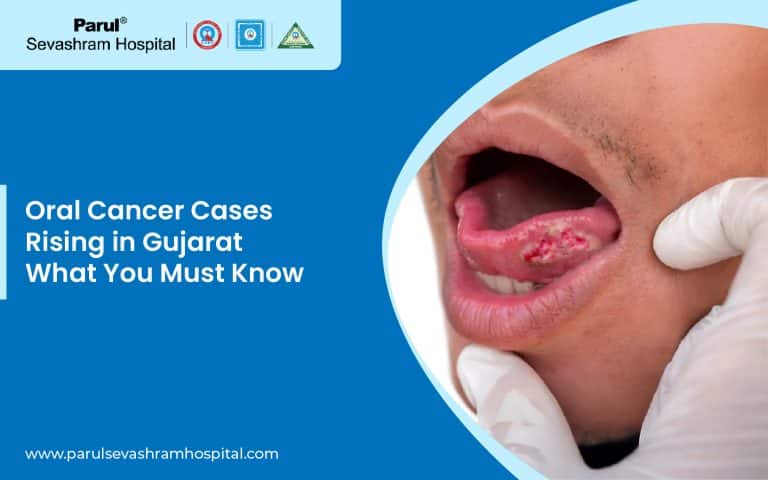 Oral Cancer in Gujarat: Causes, Risks & Early Prevention