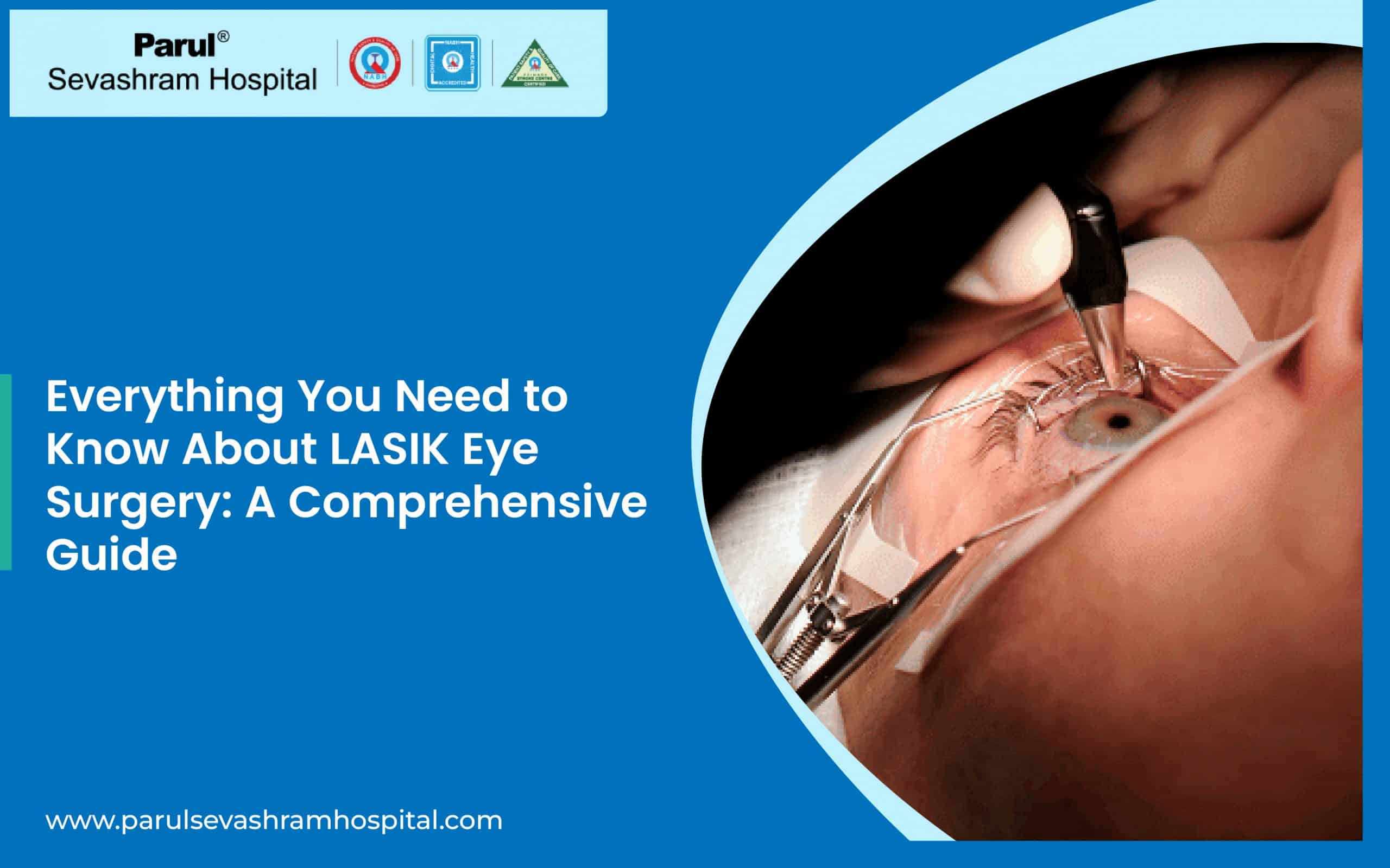 Everything You Should Know About LASIK Eye Surgery